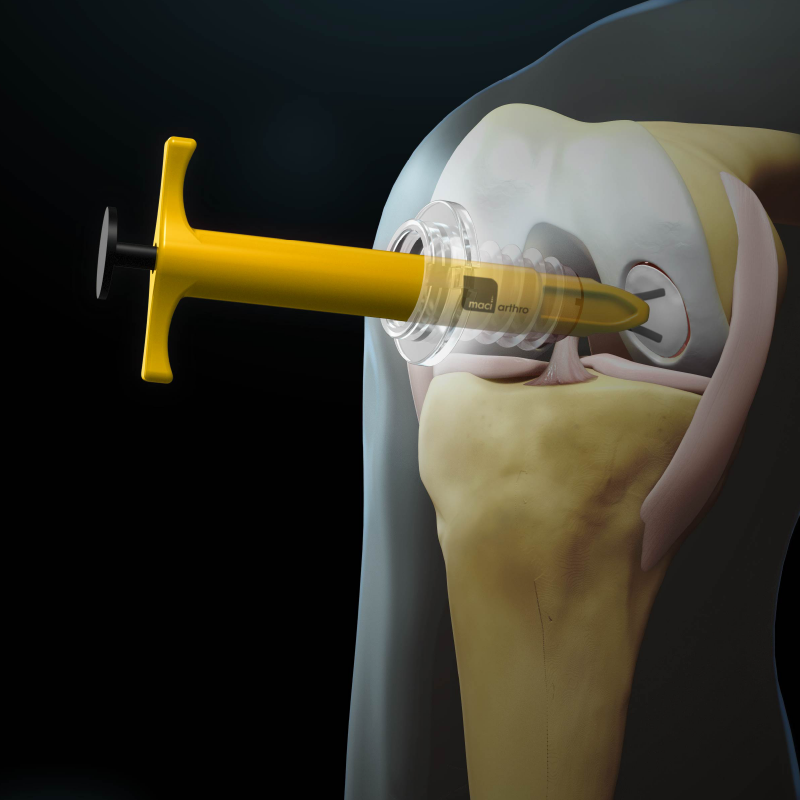 Media Resources - MACI Arthro Surgical Image